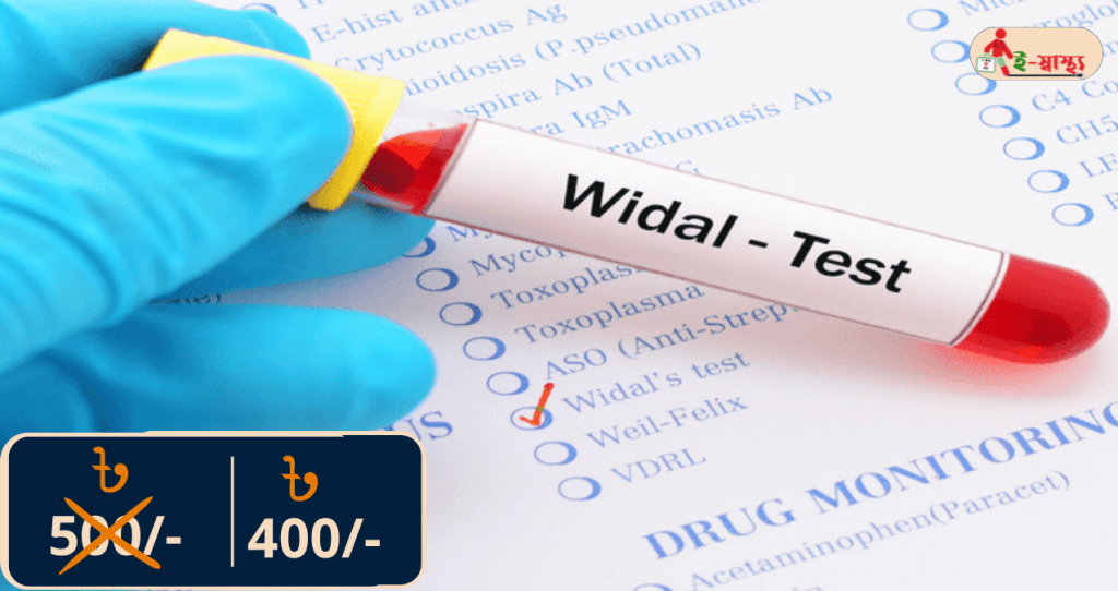 Widal Test - eSastha.com
